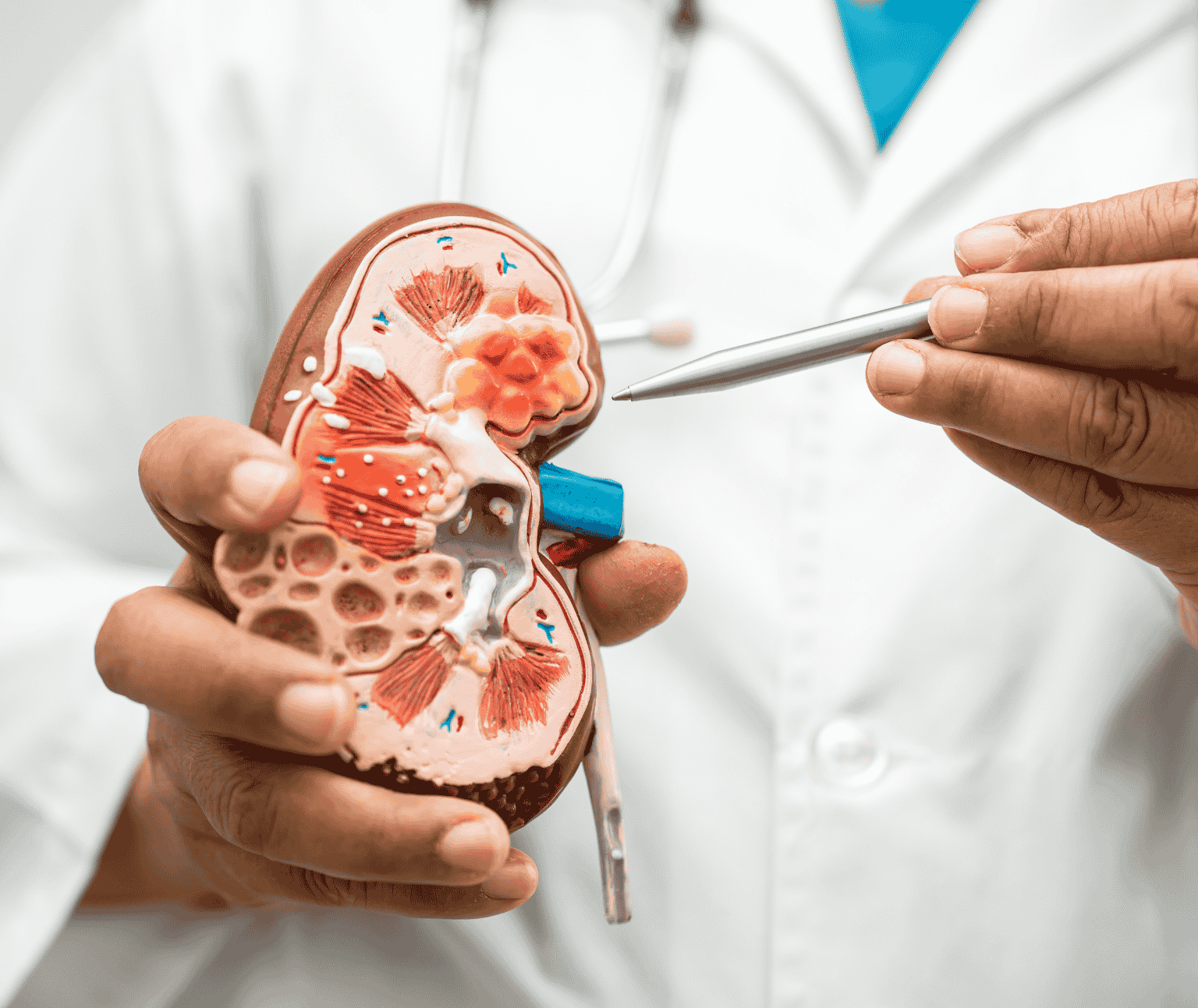 Winter Dehydration & Kidney Stones – What You Must Know